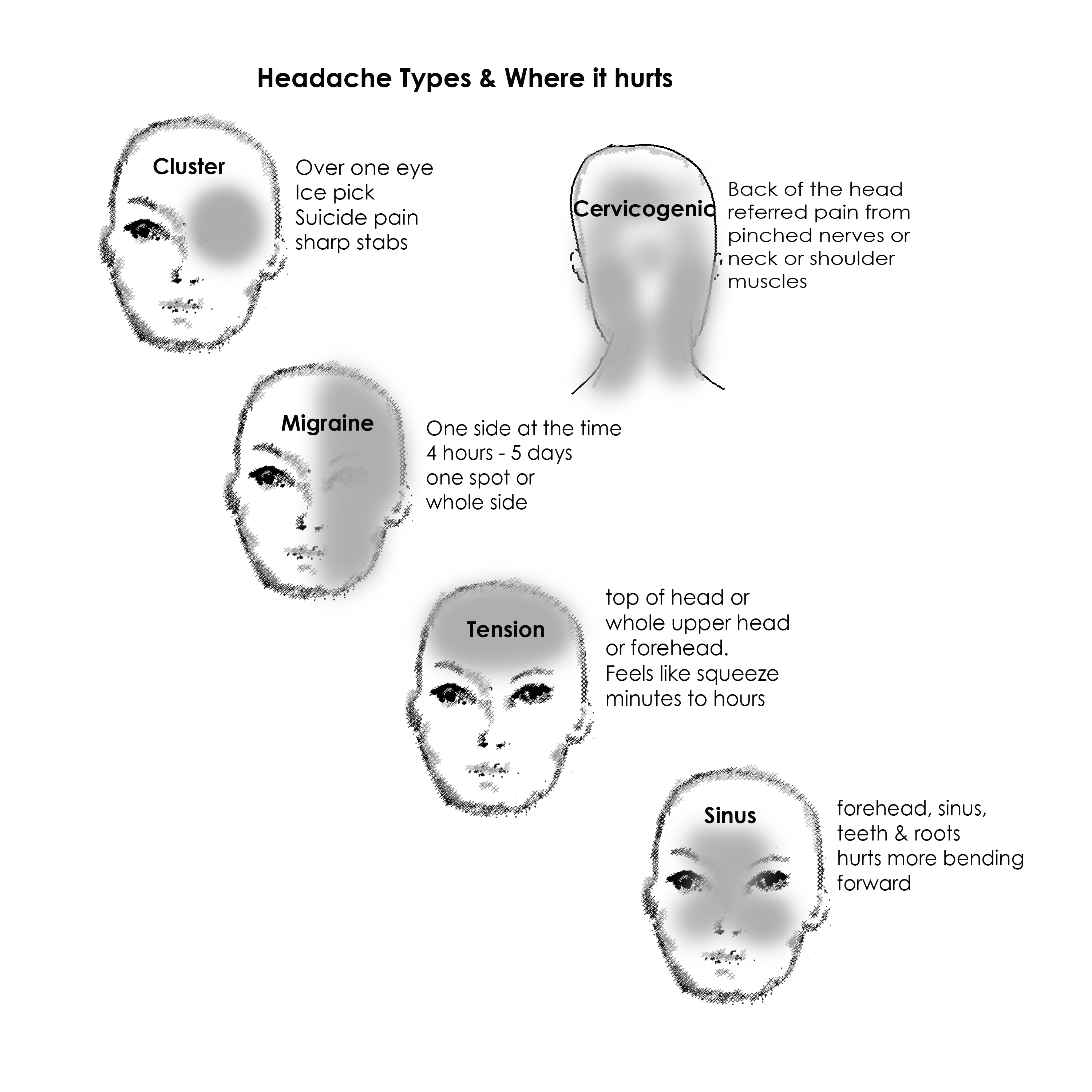Headache Types Fighting The Migraine Epidemic